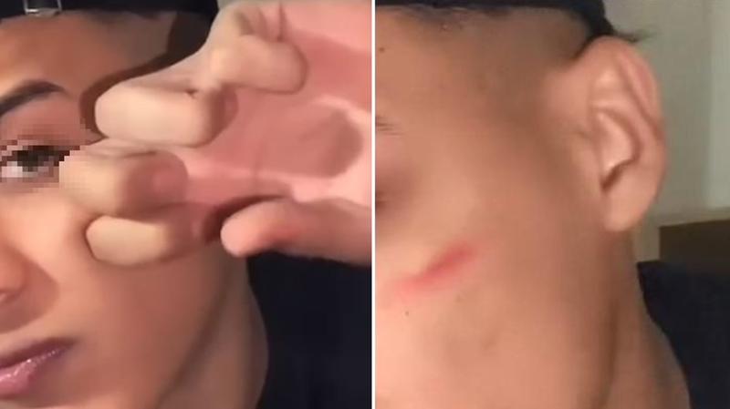 Sfida Della «cicatrice Francese Lantitrust Indaga Su «tik Tok Larena
